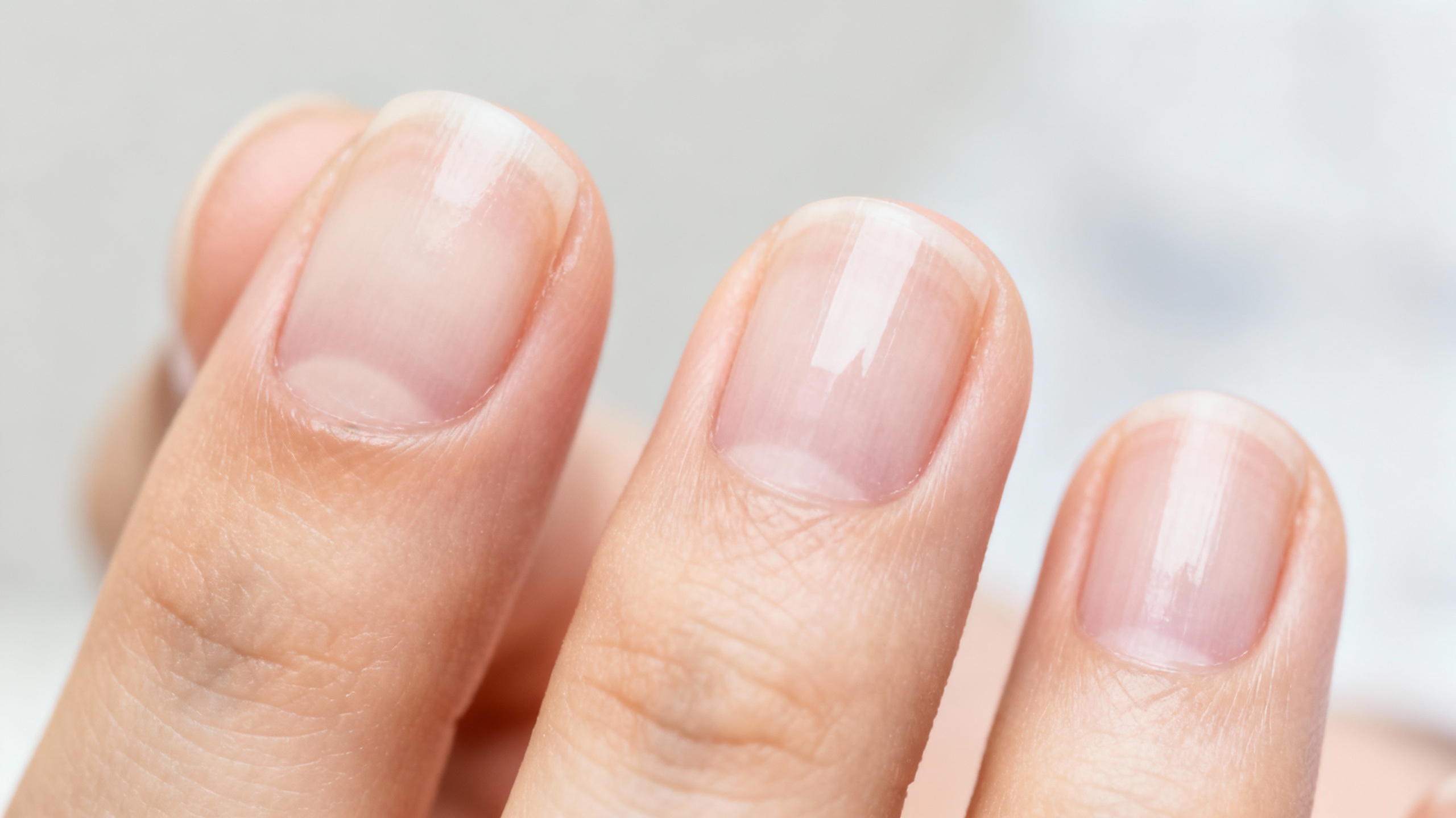 Ringworm On Nails